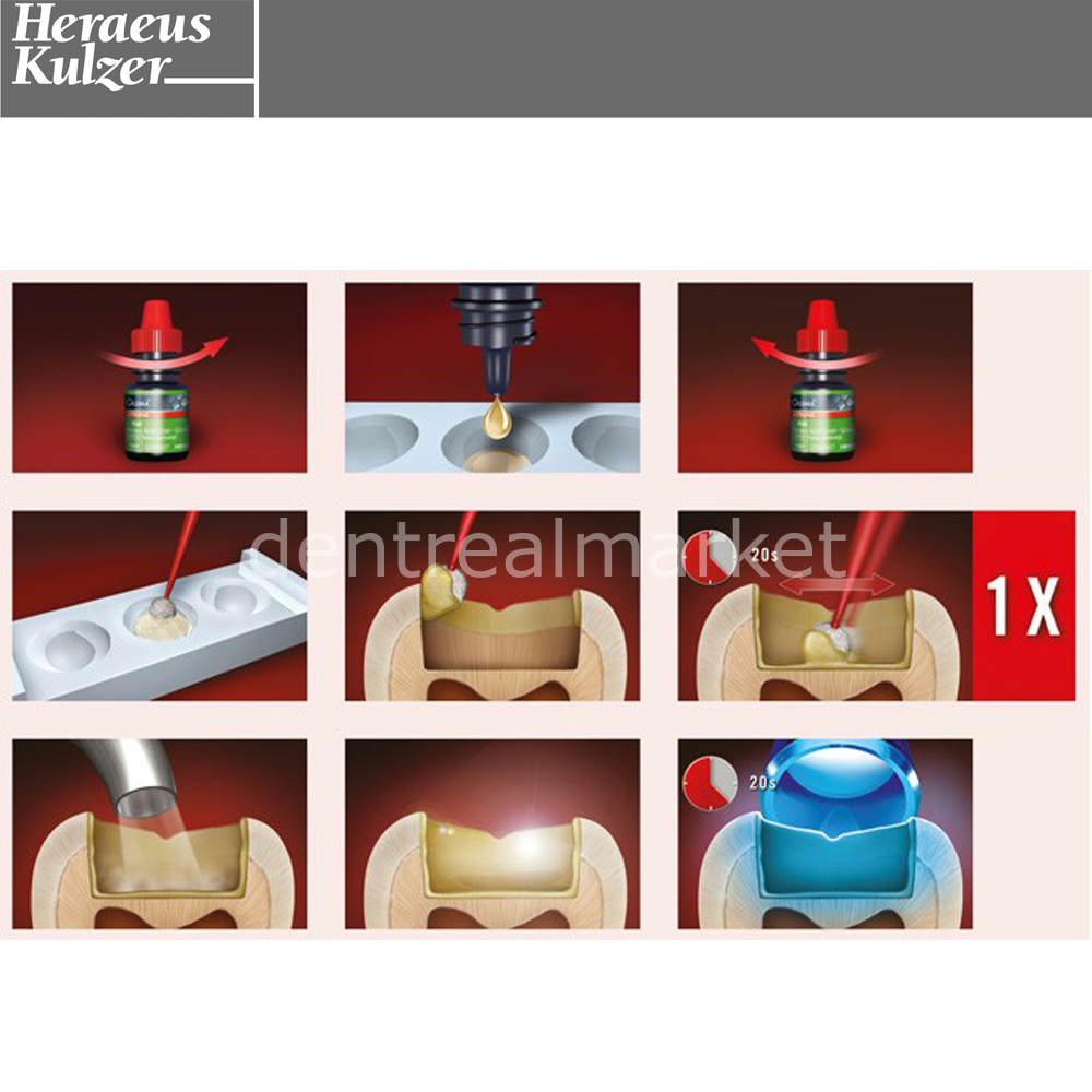 Gluma Self Etch Bond Value Pack | Kulzer