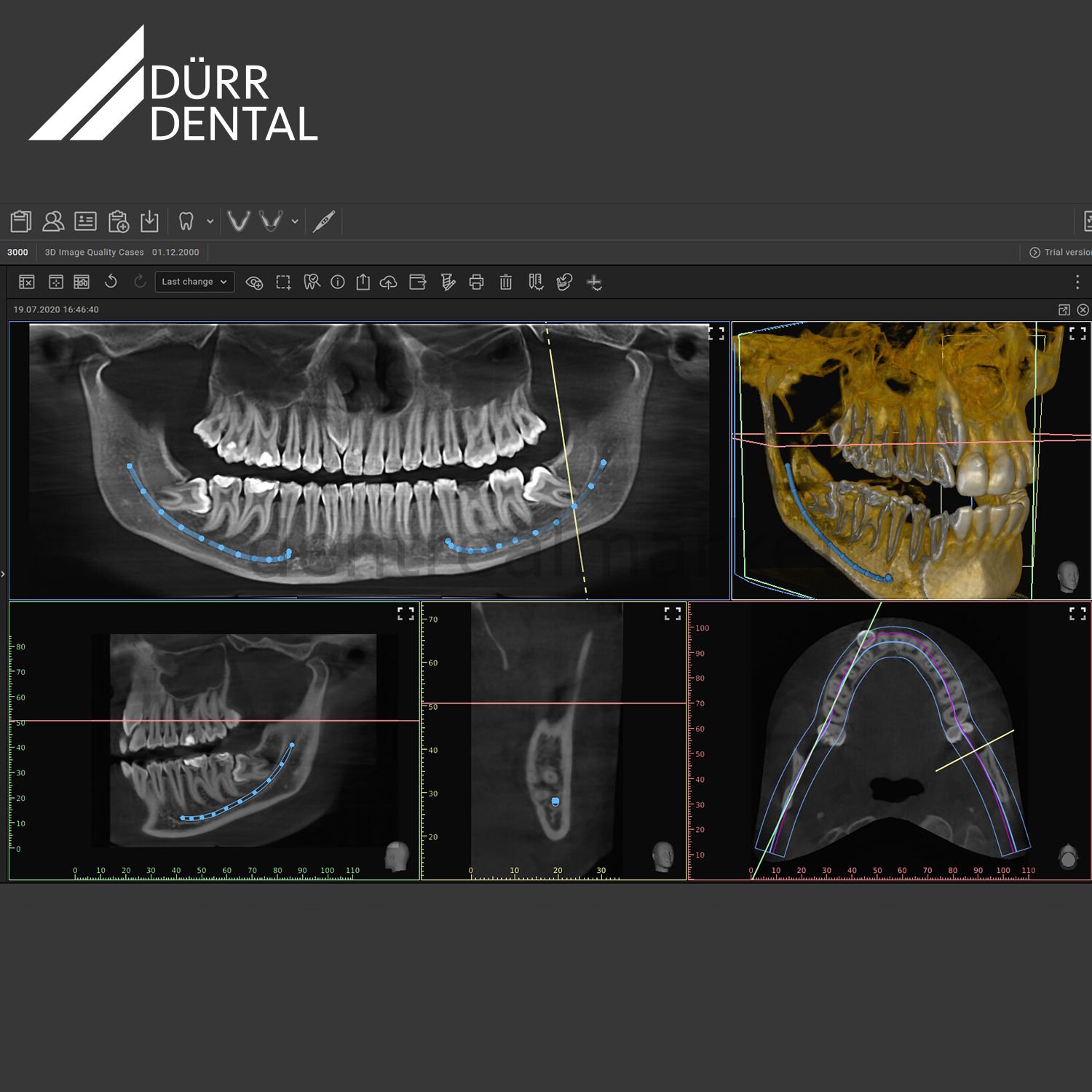 VistaVox S 3D Volumetrik Tomografi & Panoromik Röntgen | Dürr Dental