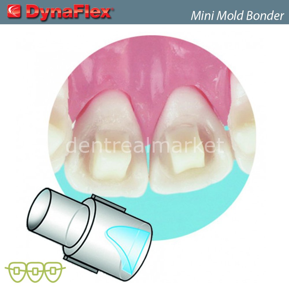 Mini Mold Bonder Ramp | Dynaflex